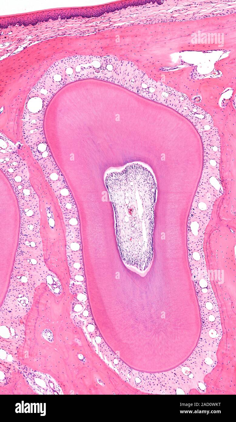 Light microscopy of a tooth. This section is below the gumline and ...
