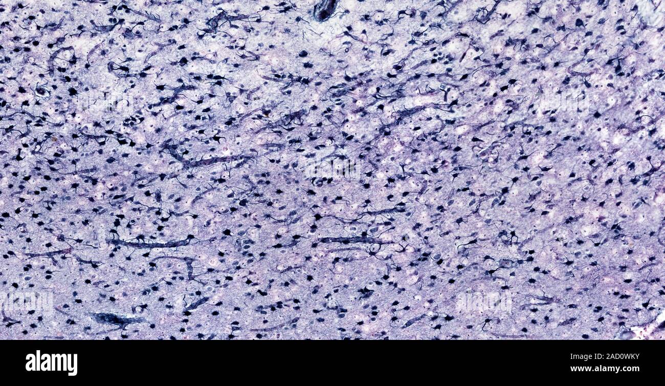 Light microscopy of brain tissue. The gray matter of the cerebral ...