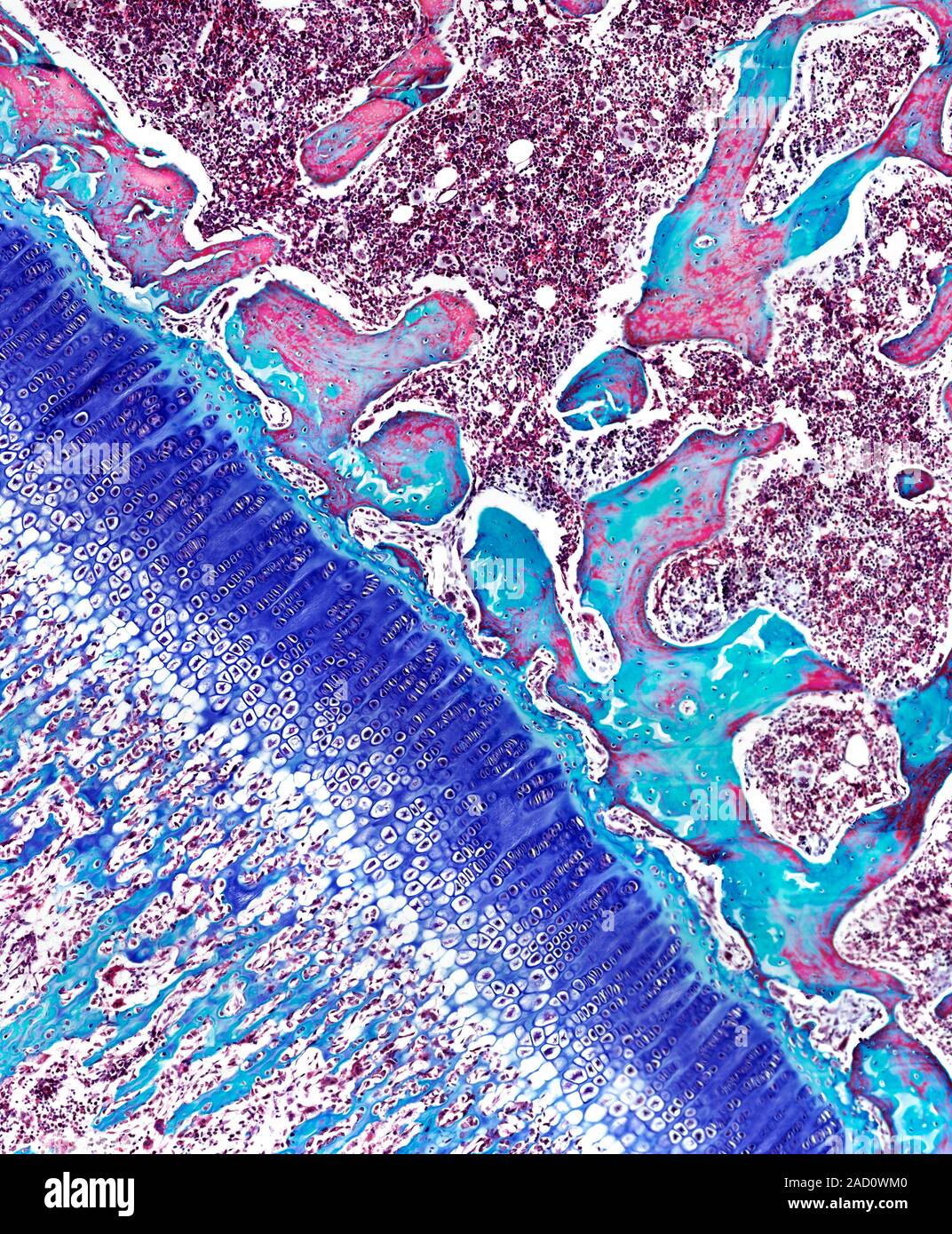 Light microscopy of a growth plate in a growing bone. The growth plate ...