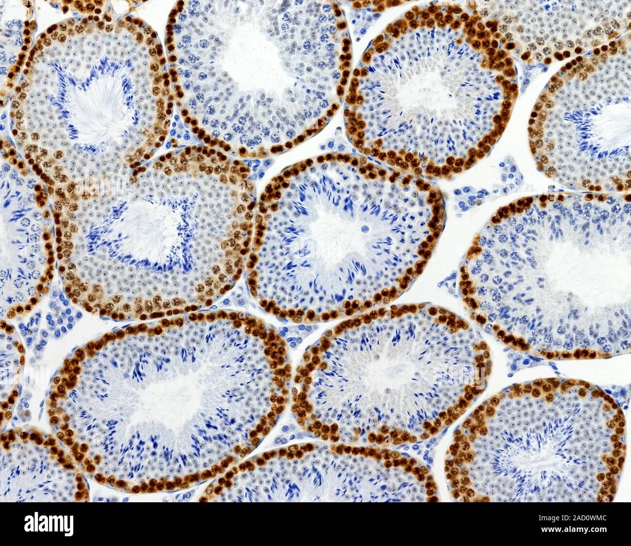 Light microscopy of the testis. Seminiferous tubules are shown in cross ...