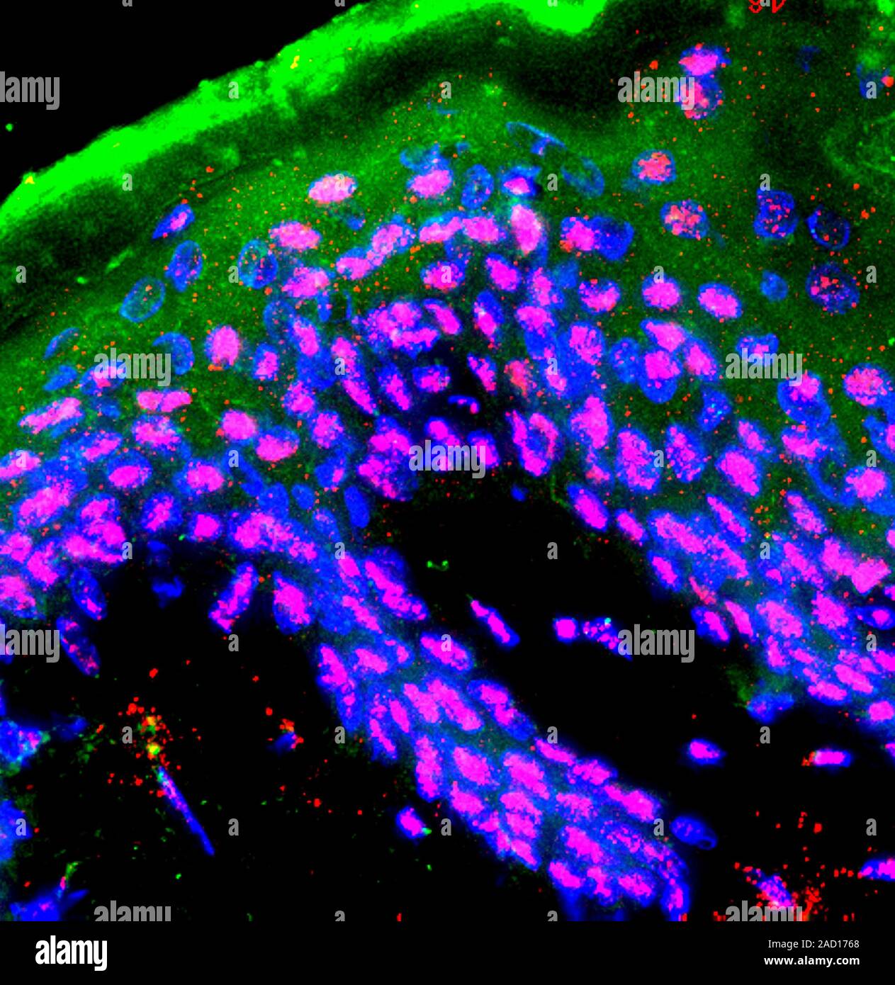 Skin tissue. Fluorescent deconvolution light micrograph of a section ...