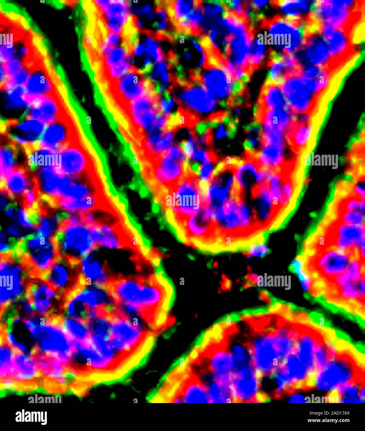 Intestinal villi. Fluorescent deconvolution light micrograph of a ...