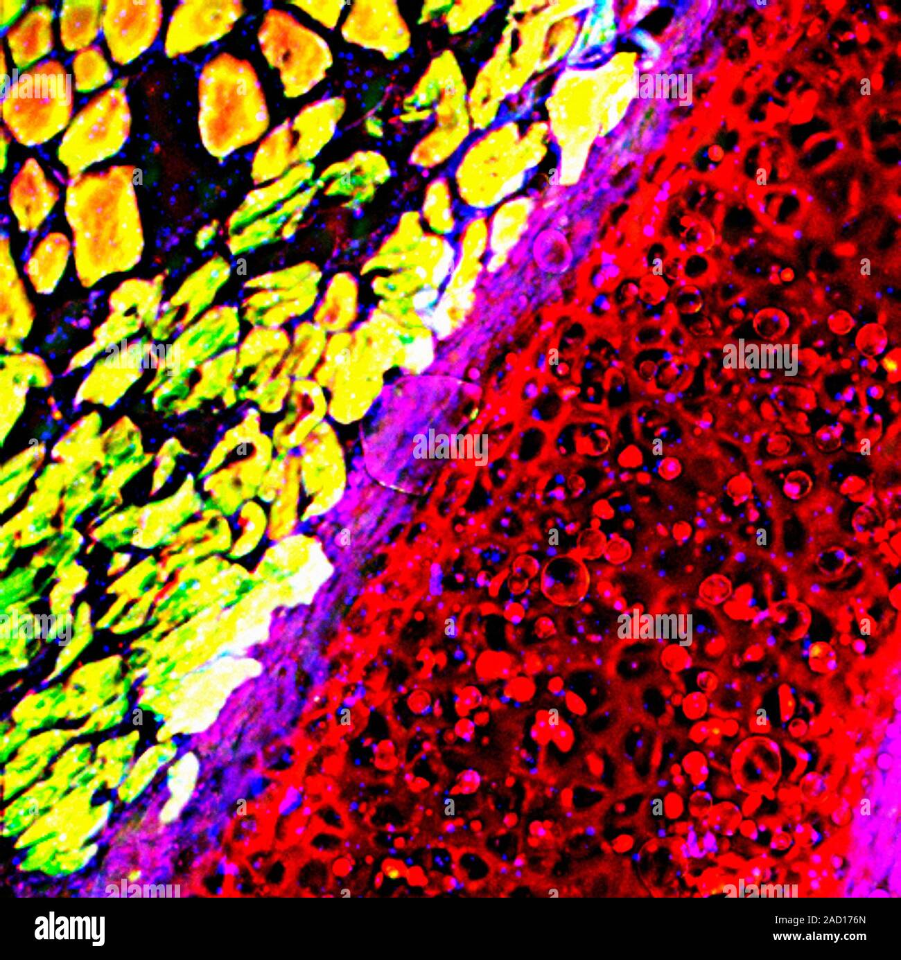 Trachea. Fluorescent deconvolution light micrograph of a section ...