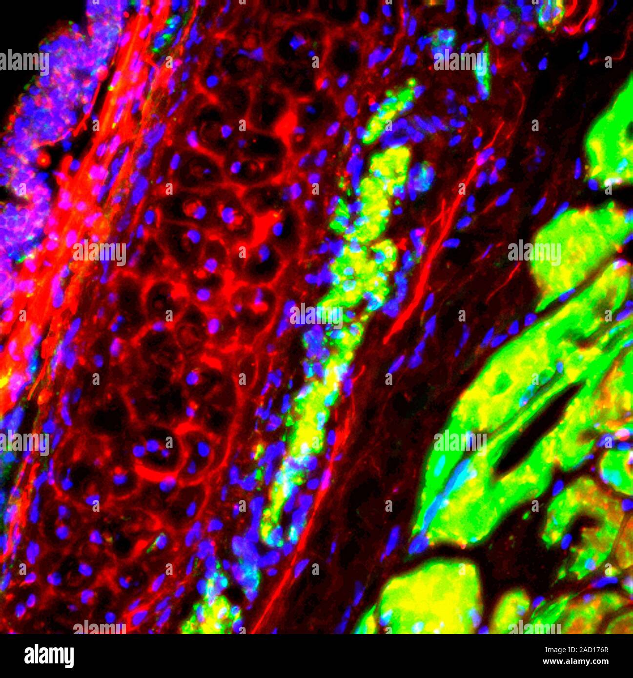 Trachea. Fluorescent deconvolution light micrograph of a section ...