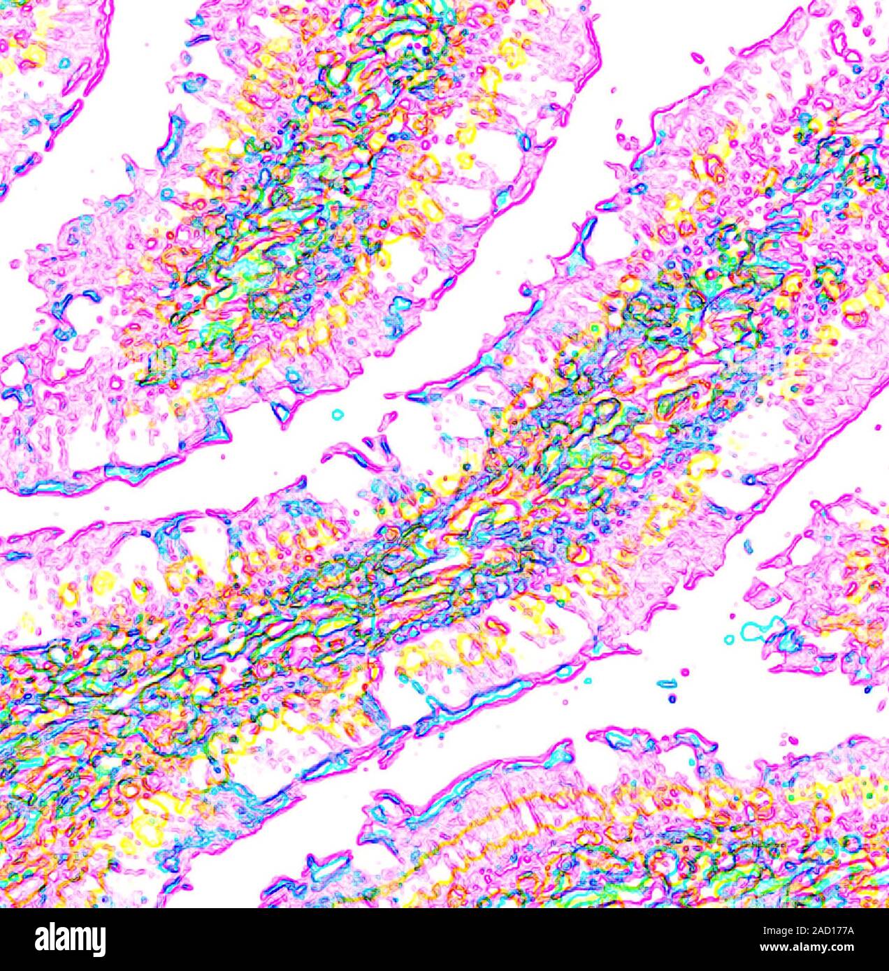 Intestinal villi. Fluorescent deconvolution light micrograph of a ...