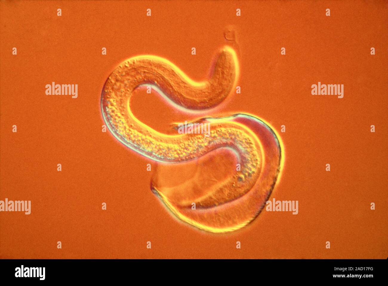 Roundworm hatching. Differential interference contrast micrograph of a ...