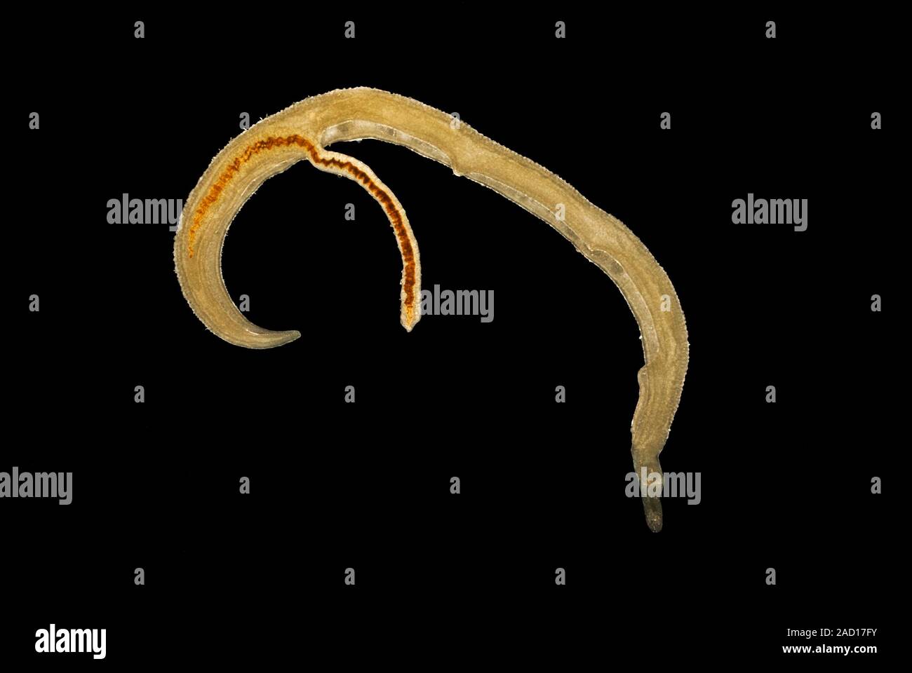 Schistosome fluke worm. Darkfield light micrograph of a Schistosoma ...