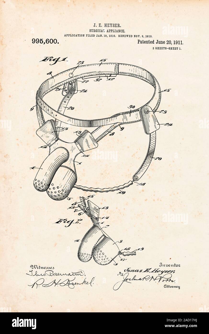 Male chastity belt patent, 1910. Artwork of a device designed by Jonas ...