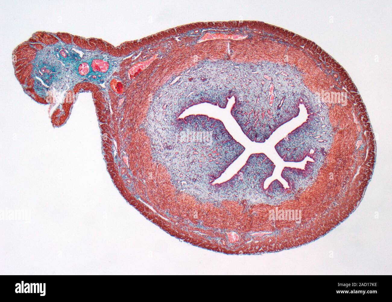 Uterine. Light micrograph of a section through the whole of the uterus ...