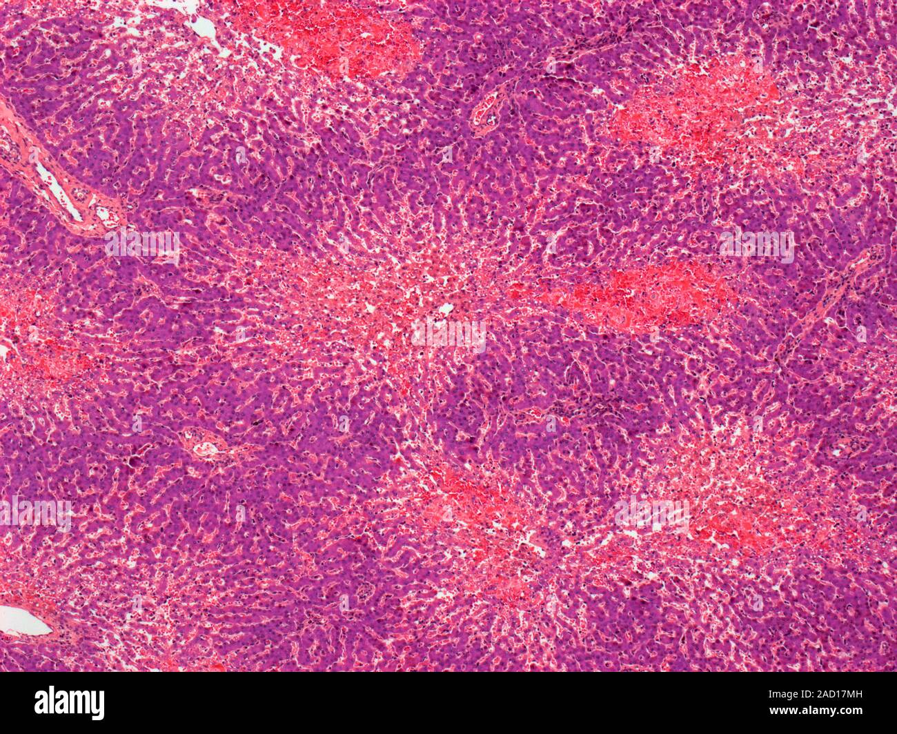 Canine parvovirus, Light micrograph of a section from an affected dog ...