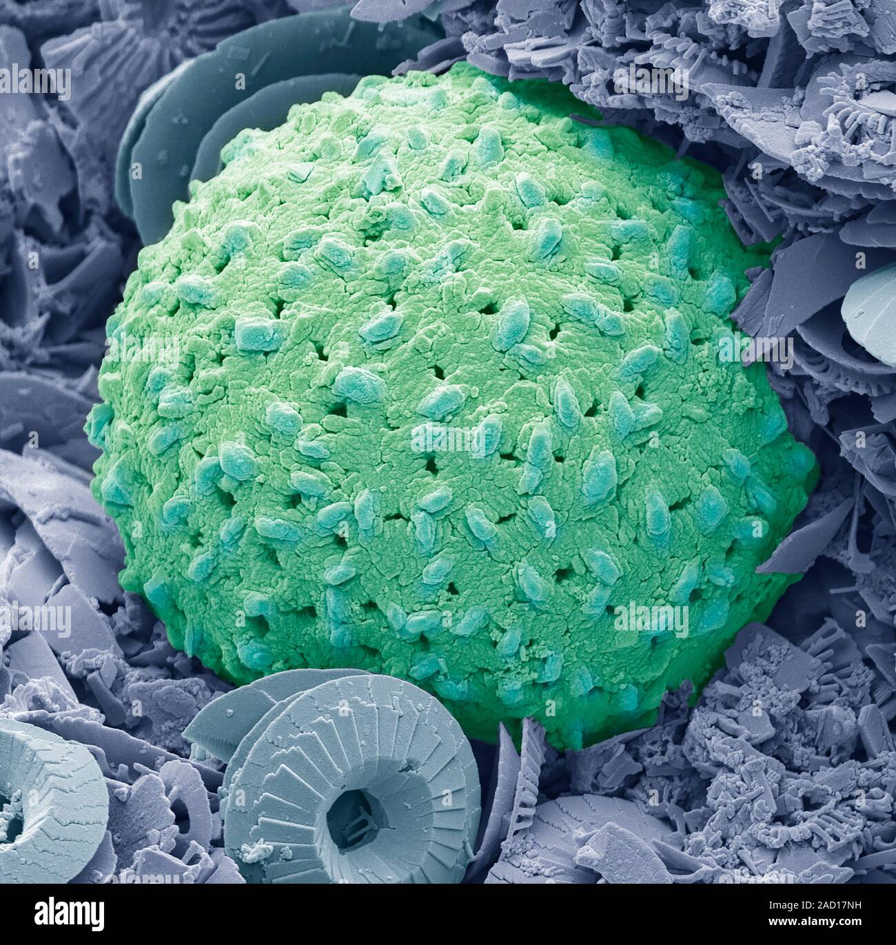 Dinoflagellate protozoan. Coloured scanning electron micrograph (SEM ...