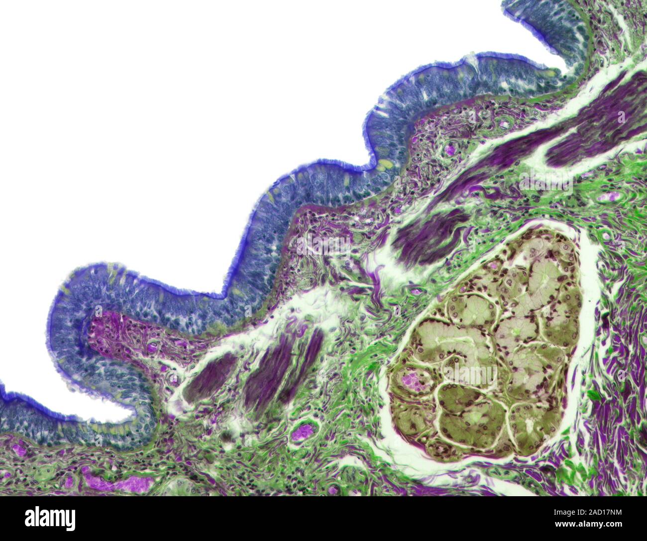 Lung bronchus. Light micrograph of a section through a human bronchus ...