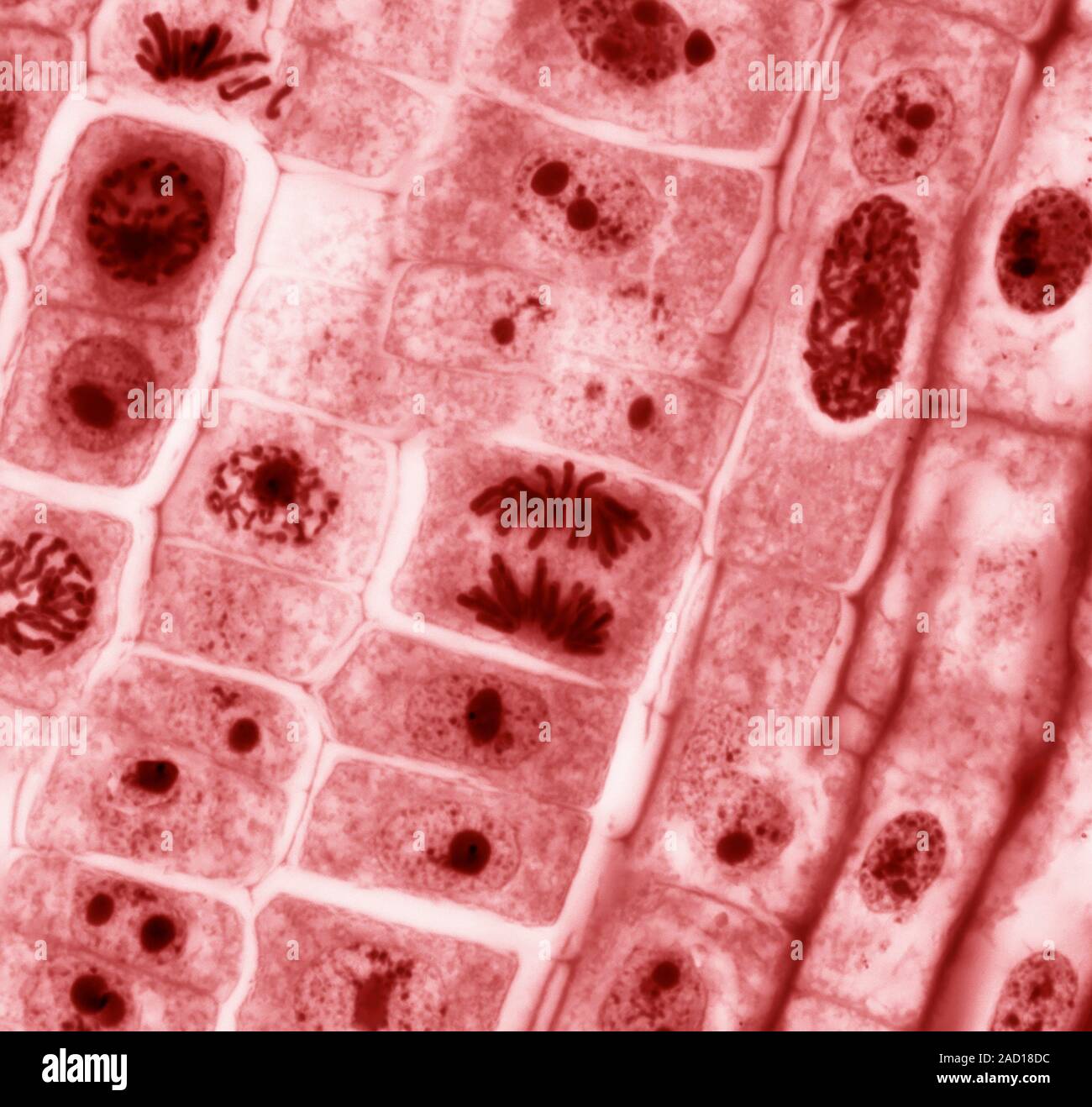 Mitosis. Light micrograph of onion (Allium cepa) root tip cells ...