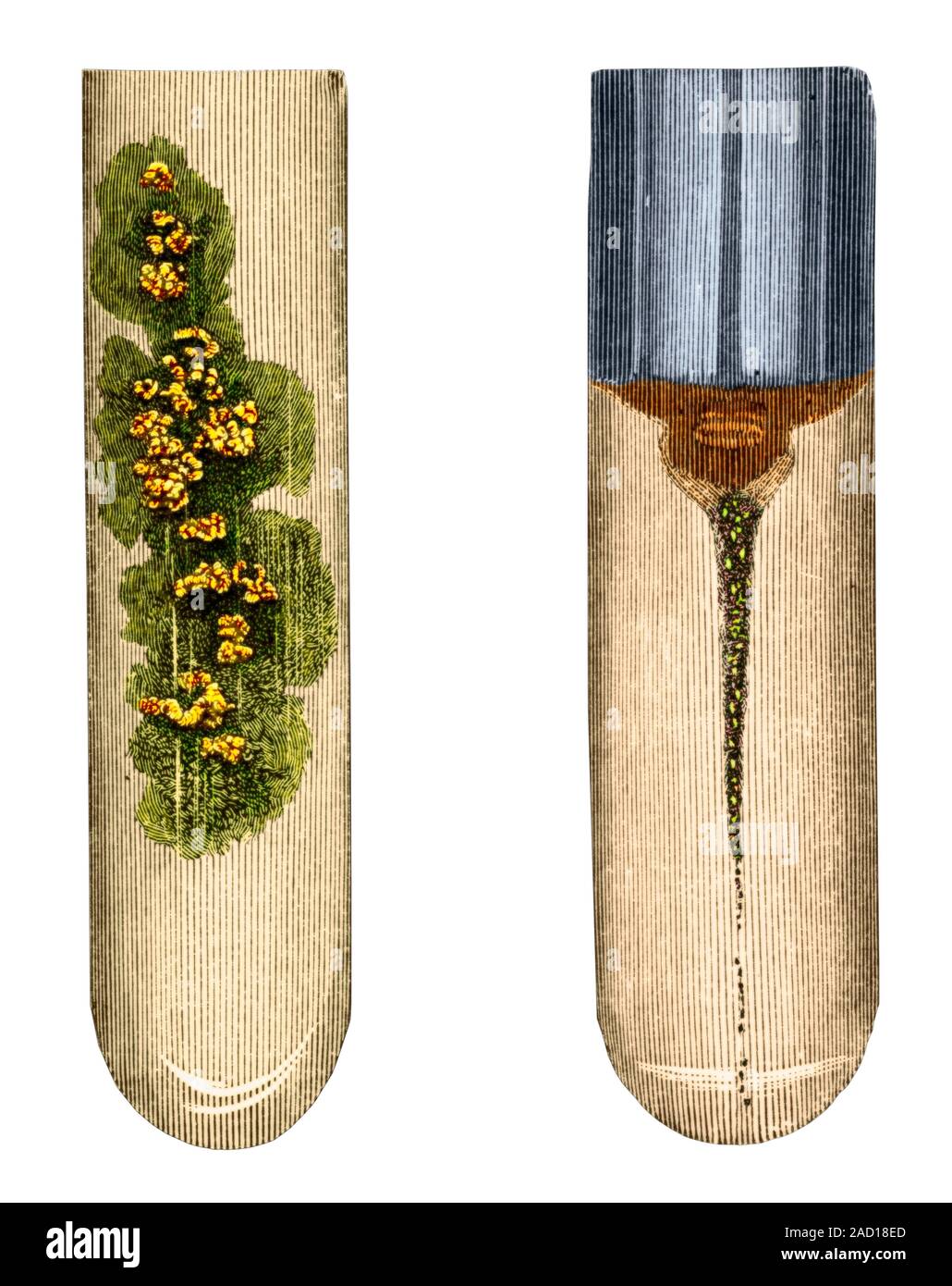 Tuberculosis and cholera research. These test tubes are from the ...