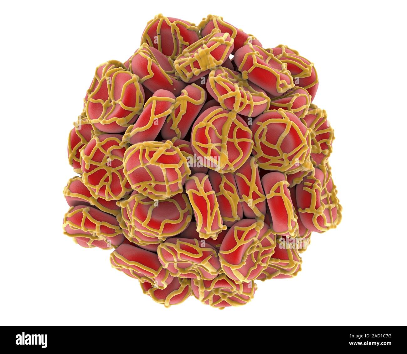 Blood clot. Computer artwork of red blood cells (erythrocytes) trapped ...
