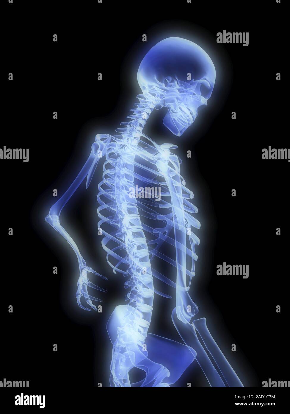 Back pain. Conceptual computer artwork of a human skeleton holding a ...