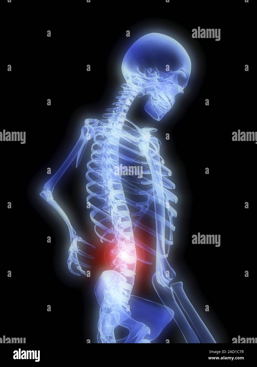 Back pain. Conceptual computer artwork of a human skeleton holding a ...