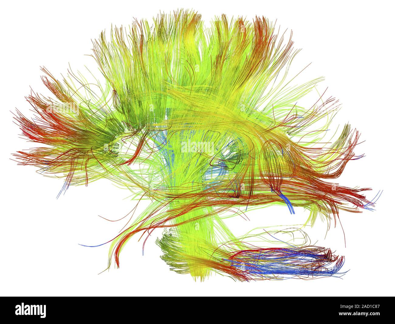 White matter fibres. Coloured 3D diffusion spectral imaging (DSI) scan ...