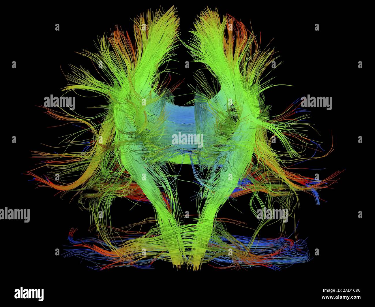 White matter fibres. Coloured 3D diffusion spectral imaging (DSI) scan ...