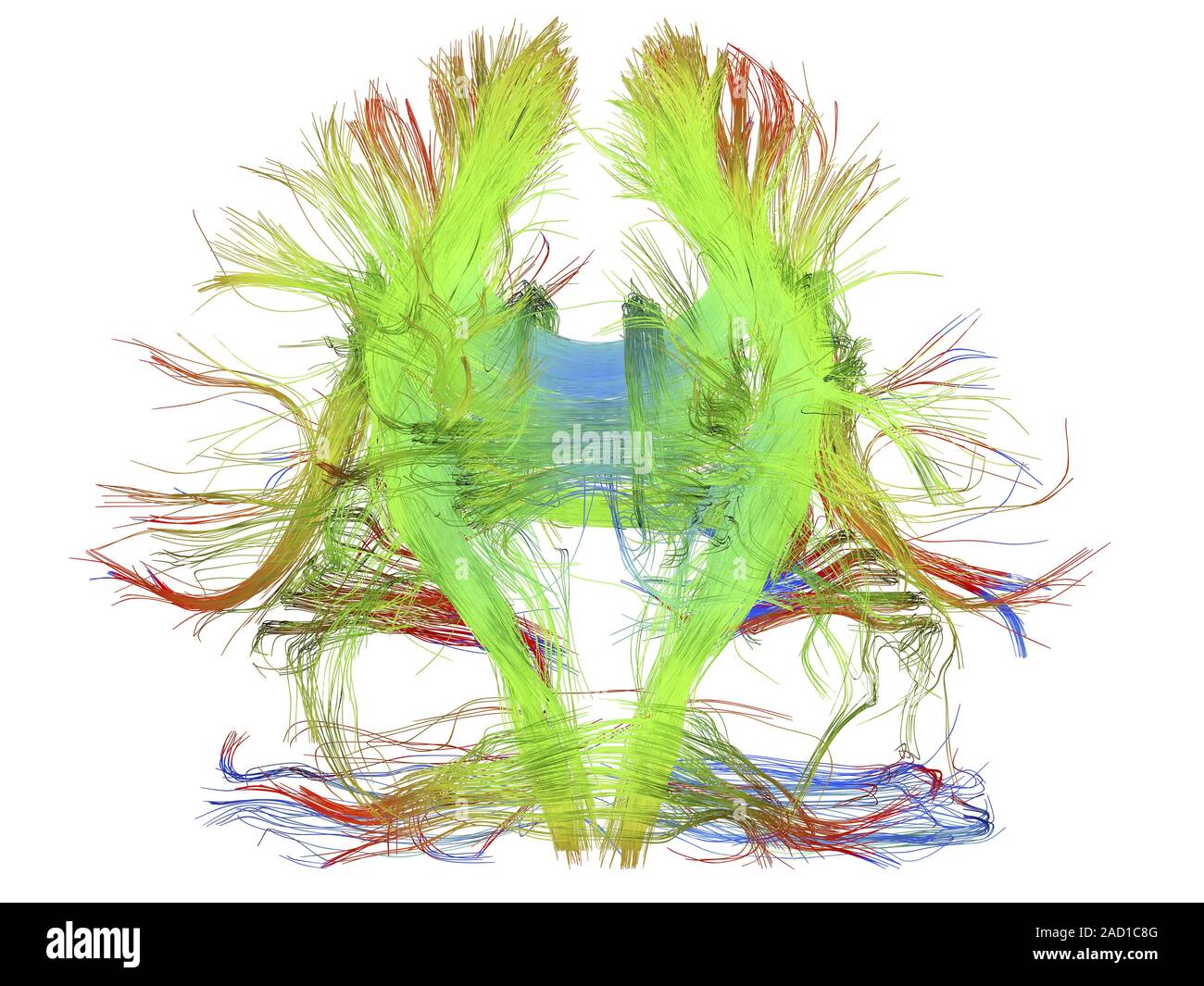 White matter fibres. Coloured 3D diffusion spectral imaging (DSI) scan ...