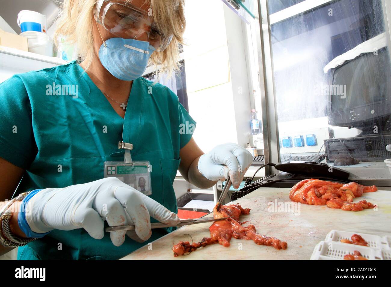 Pathology tissue sample preparation. Pathologist dissecting a tissue ...