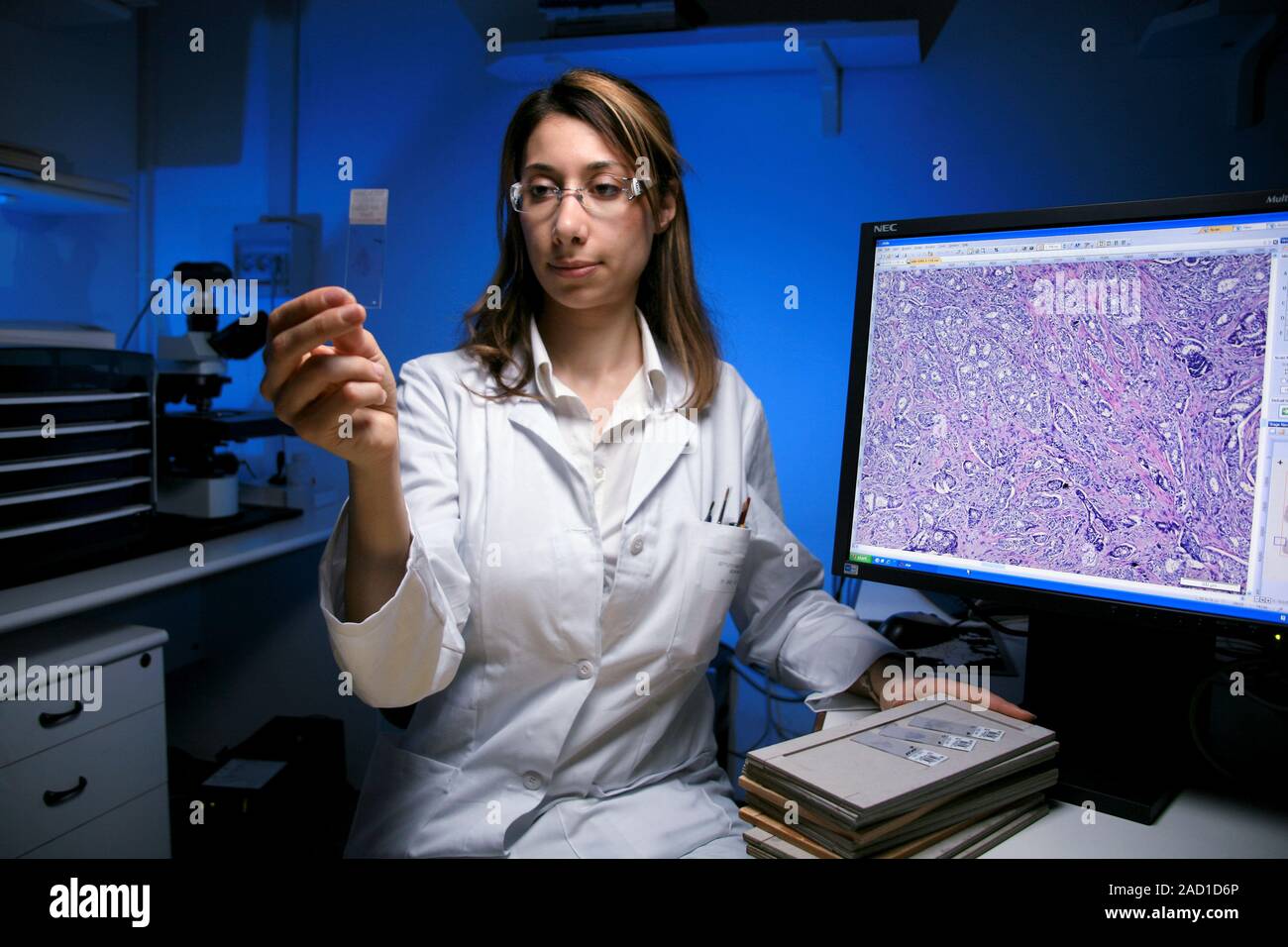 Histology research. Histologist examining a glass slide containing a ...