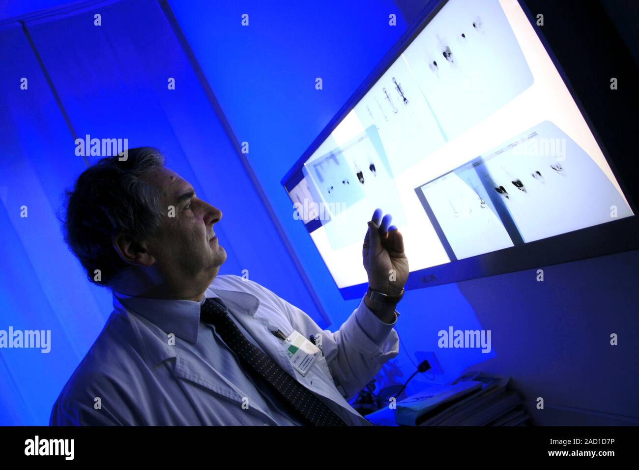 Scintigraphy diagnostics. Oncologist examining the results (on light ...