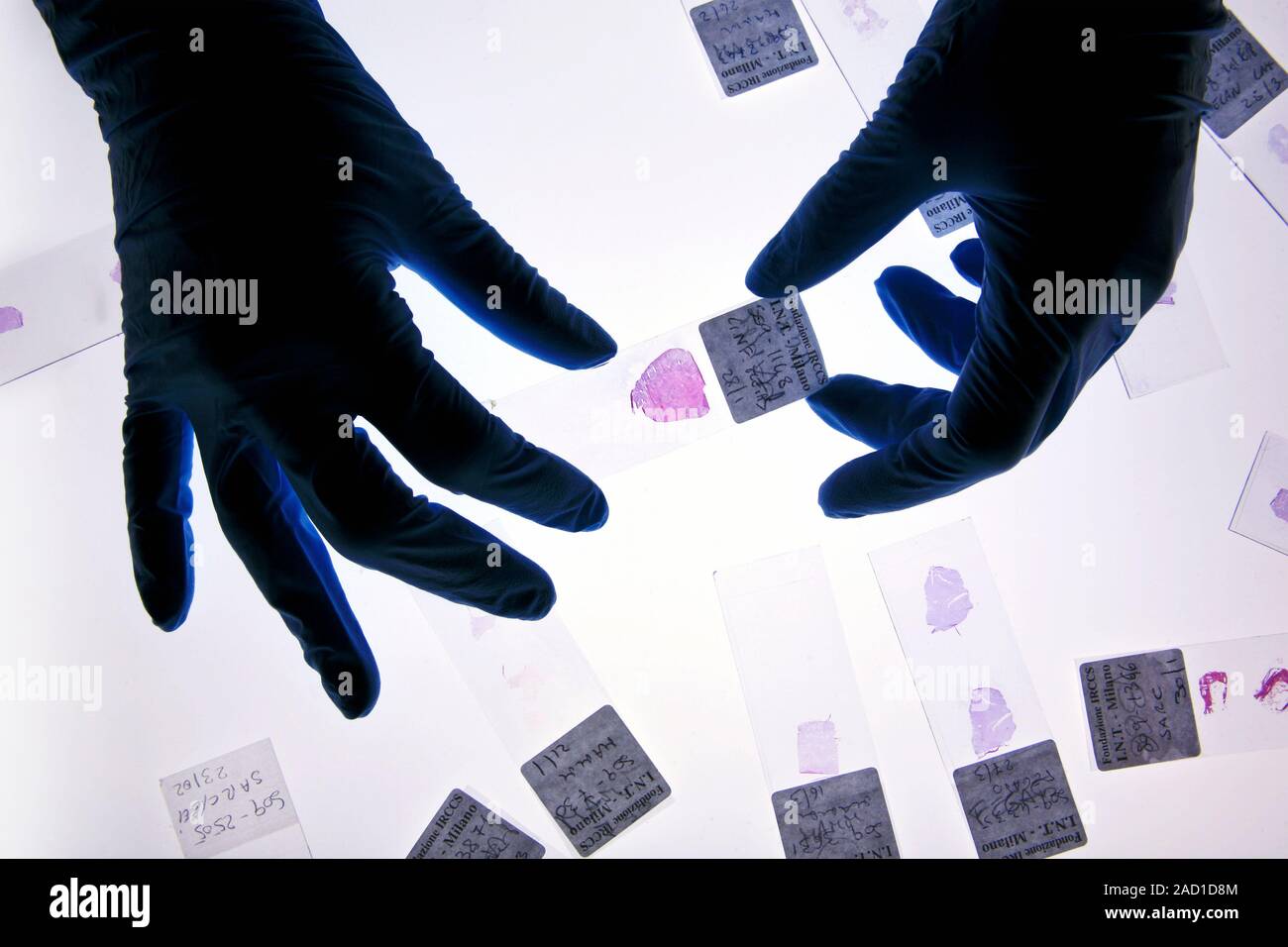 Histology tissue sample preparation. Close-up of a histologist ...