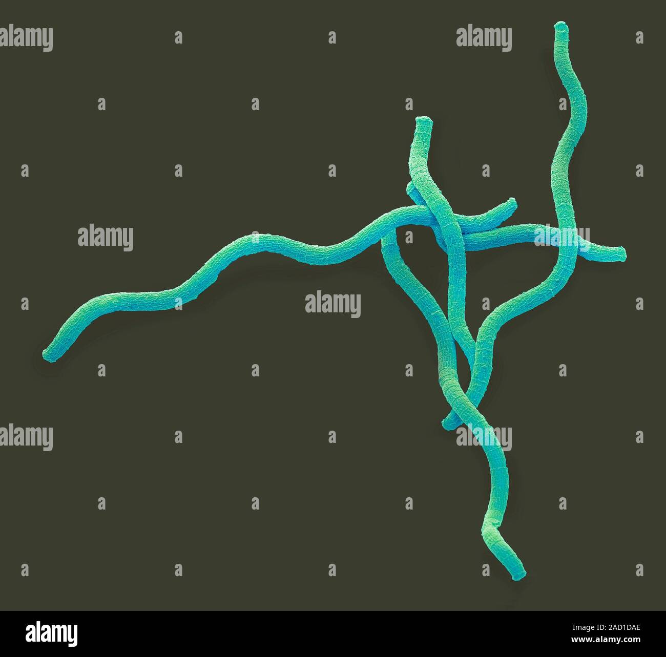 Spirulina cyanobacteria. Scanning electron micrograph (SEM). Spirulina ...