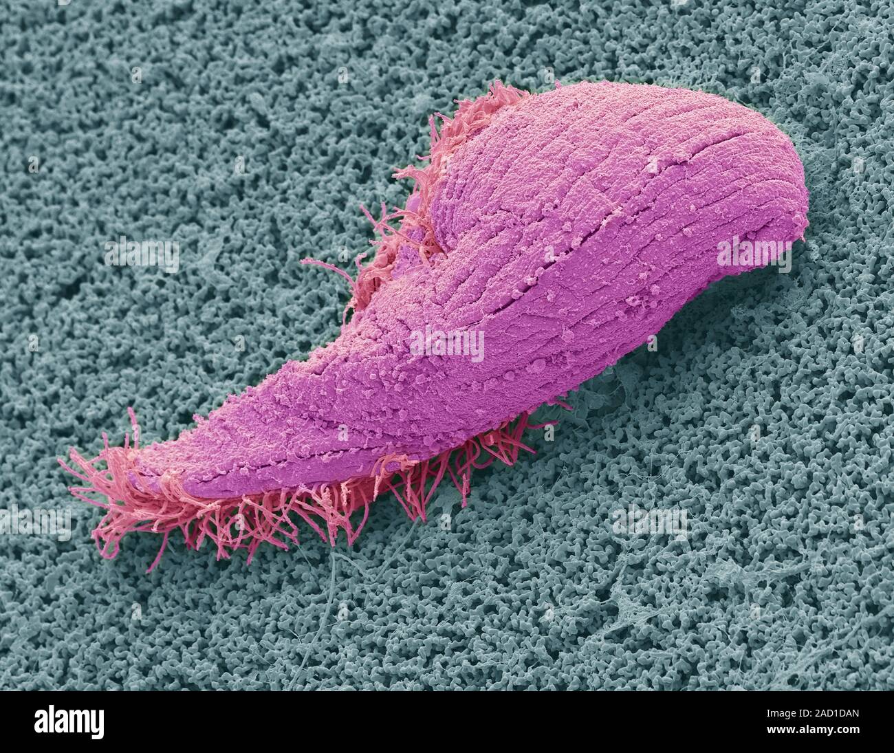 Homalozoon ciliate. Scanning electron micrograph (SEM). Homalozoon is a ...