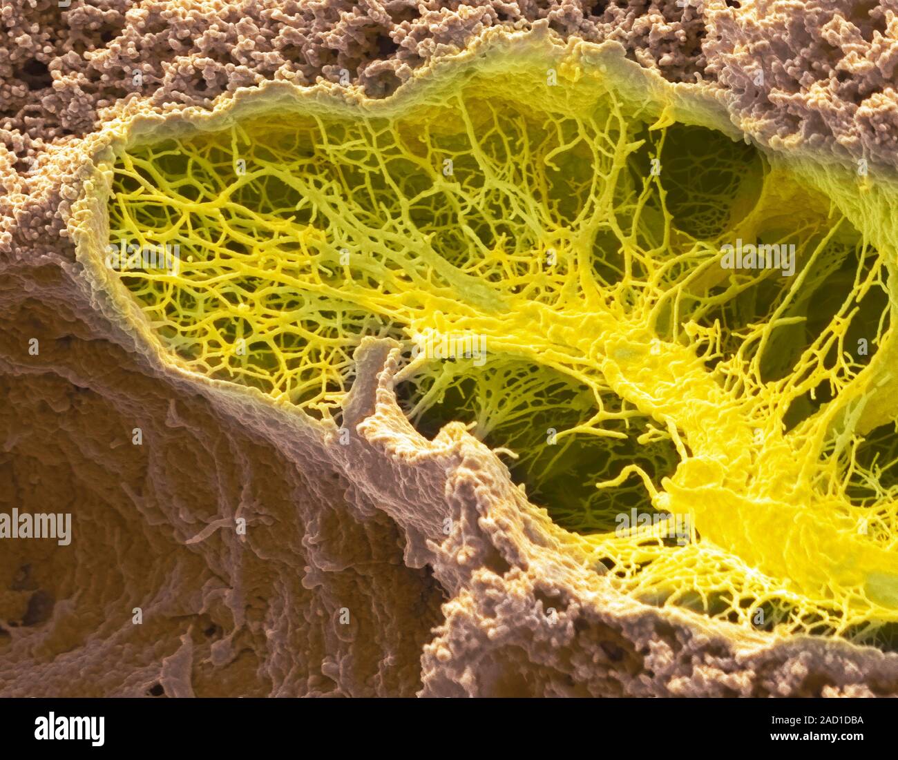 Slime mould (Physarum polycephalum). Coloured scanning electron ...