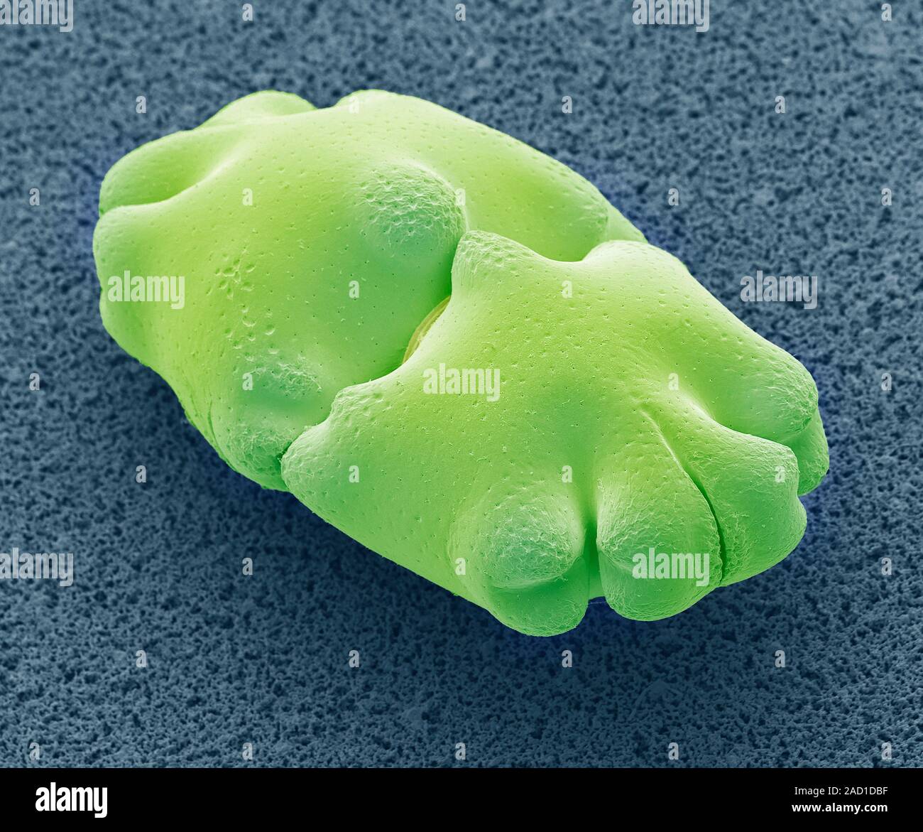 Euastrum desmid. Scanning electron micrograph (SEM) of a Euastrum ...