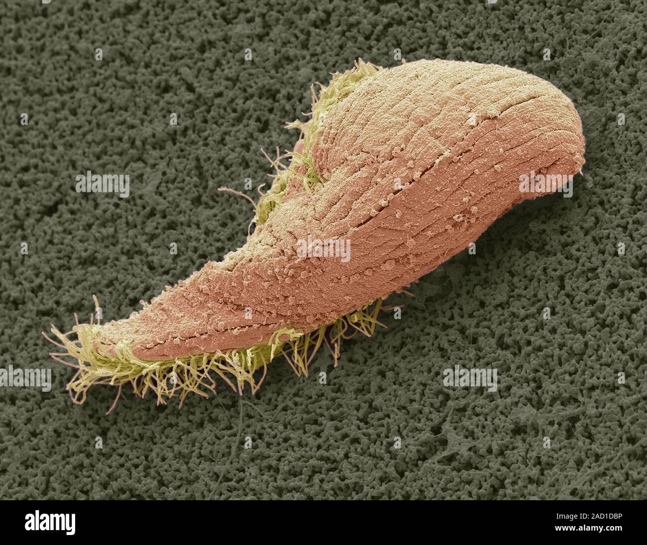 Homalozoon ciliate. Scanning electron micrograph (SEM). Homalozoon is a ...