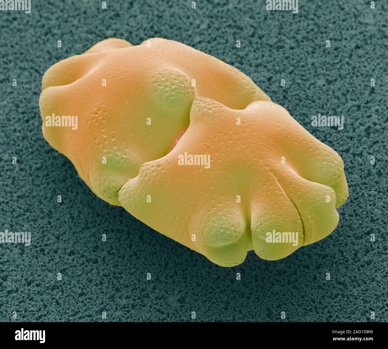 Euastrum desmid. Scanning electron micrograph (SEM) of a Euastrum ...