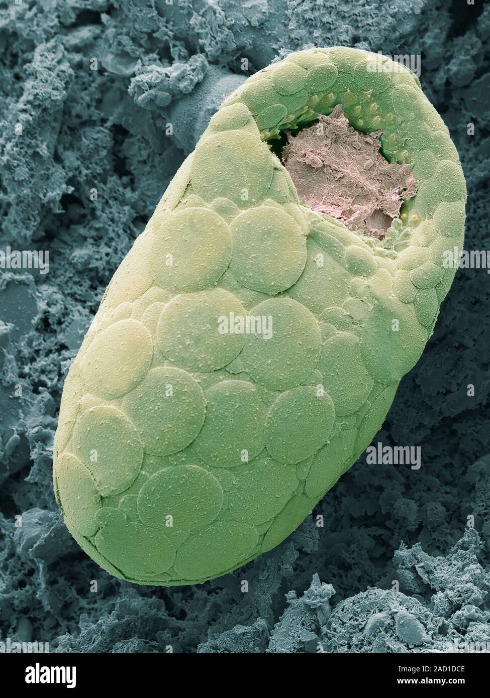 Testate amoeba in hedgehog faeces. Scanning electron micrograph (SEM ...