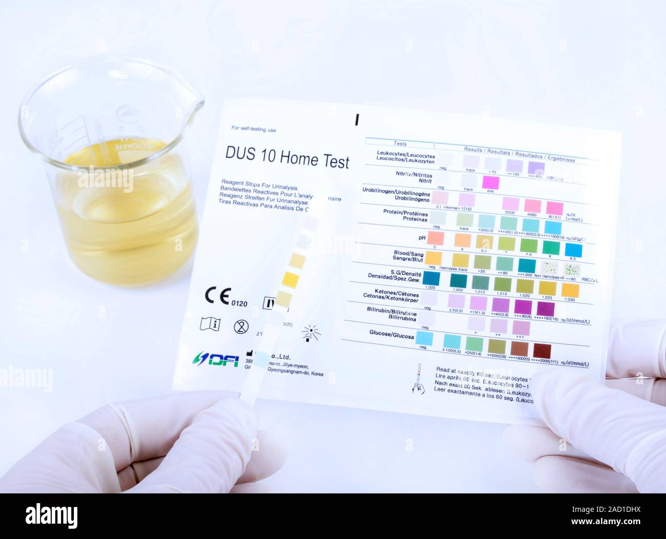 Home urine test. Home test kit for testing urine for signs of diabetes ...