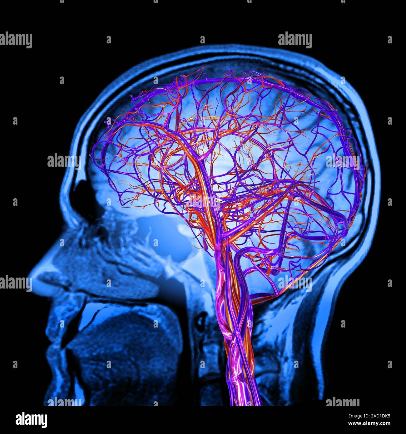 Brain vascular system. Artwork showing the arteries (red) and veins ...