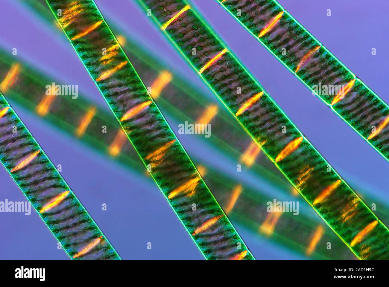 Spirogyra algae. Polarised light micrograph of Spirogyra sp. algae ...