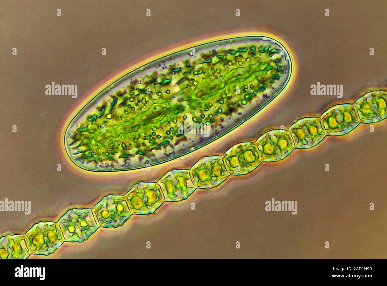 Desmids. Phase contrast light micrograph of a Netrium sp. (top) and ...