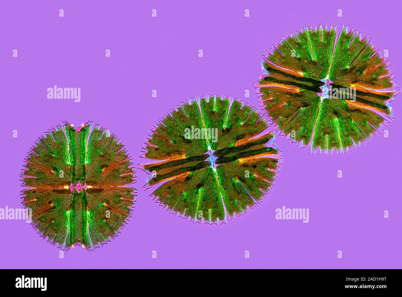 Micrasterias desmids. Polarised light micrograph of Micrasterias rotata ...