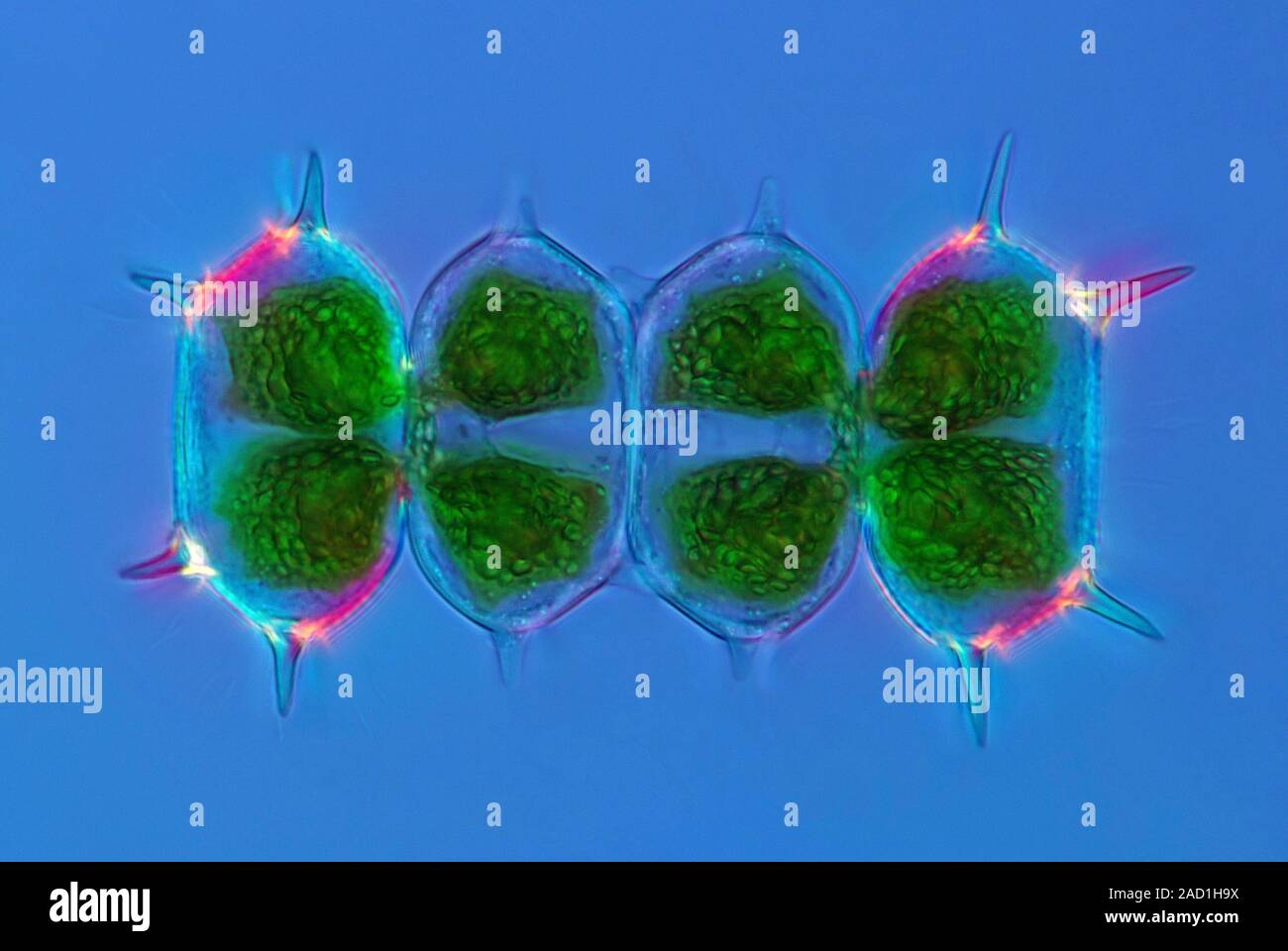 Xanthidium desmid. Polarised light micrograph of a Xanthidium sp ...
