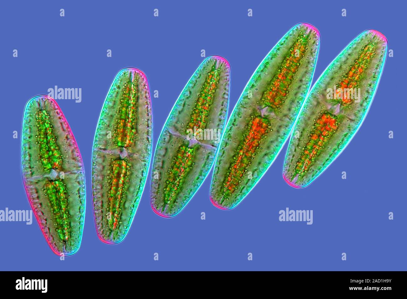 Netrium desmids. Polarised light micrograph of Netrium sp. desmids ...