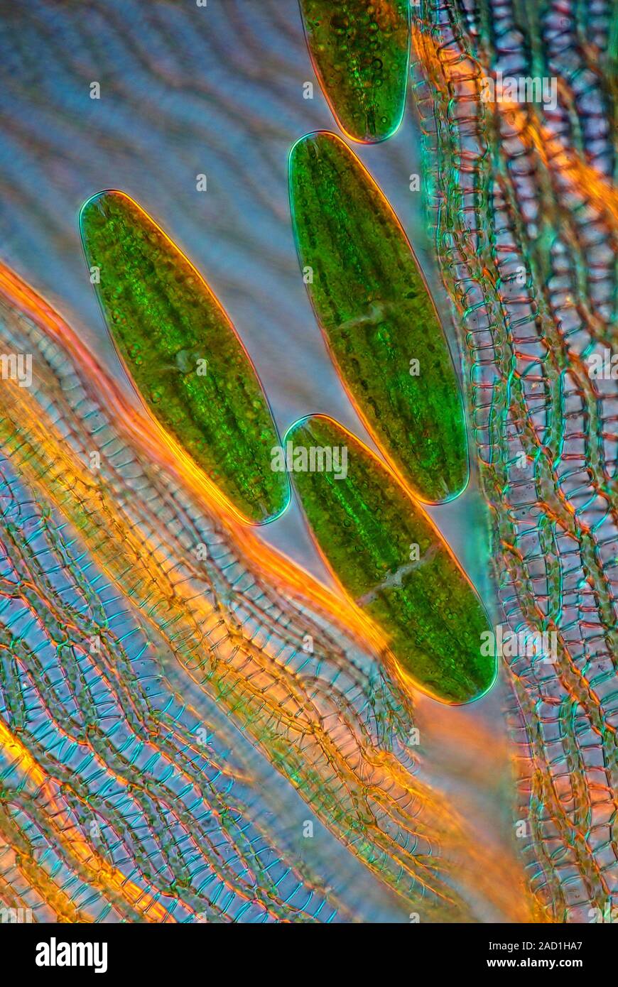 Netrium desmids. Polarised light micrograph of Netrium sp. desmids ...