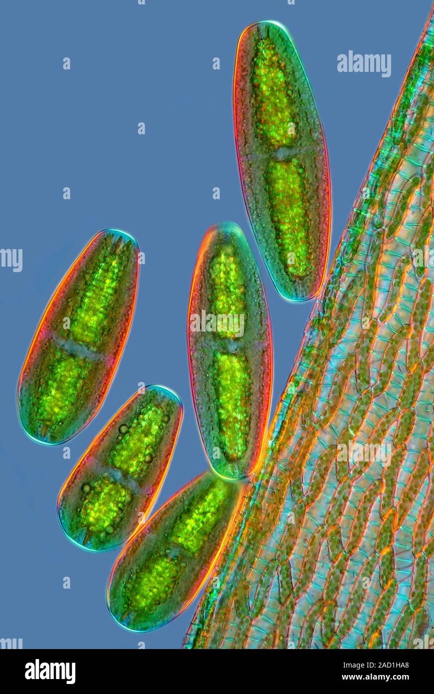 Netrium desmids. Polarised light micrograph of Netrium sp. desmids ...