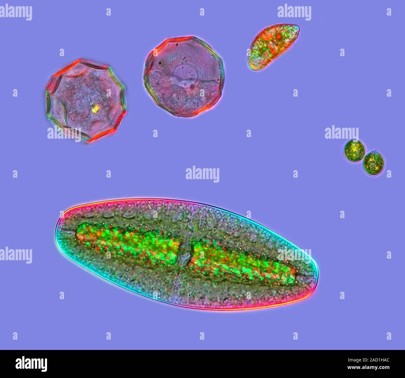 Desmids and protozoa. Polarised light micrograph of Netrium sp. desmids ...