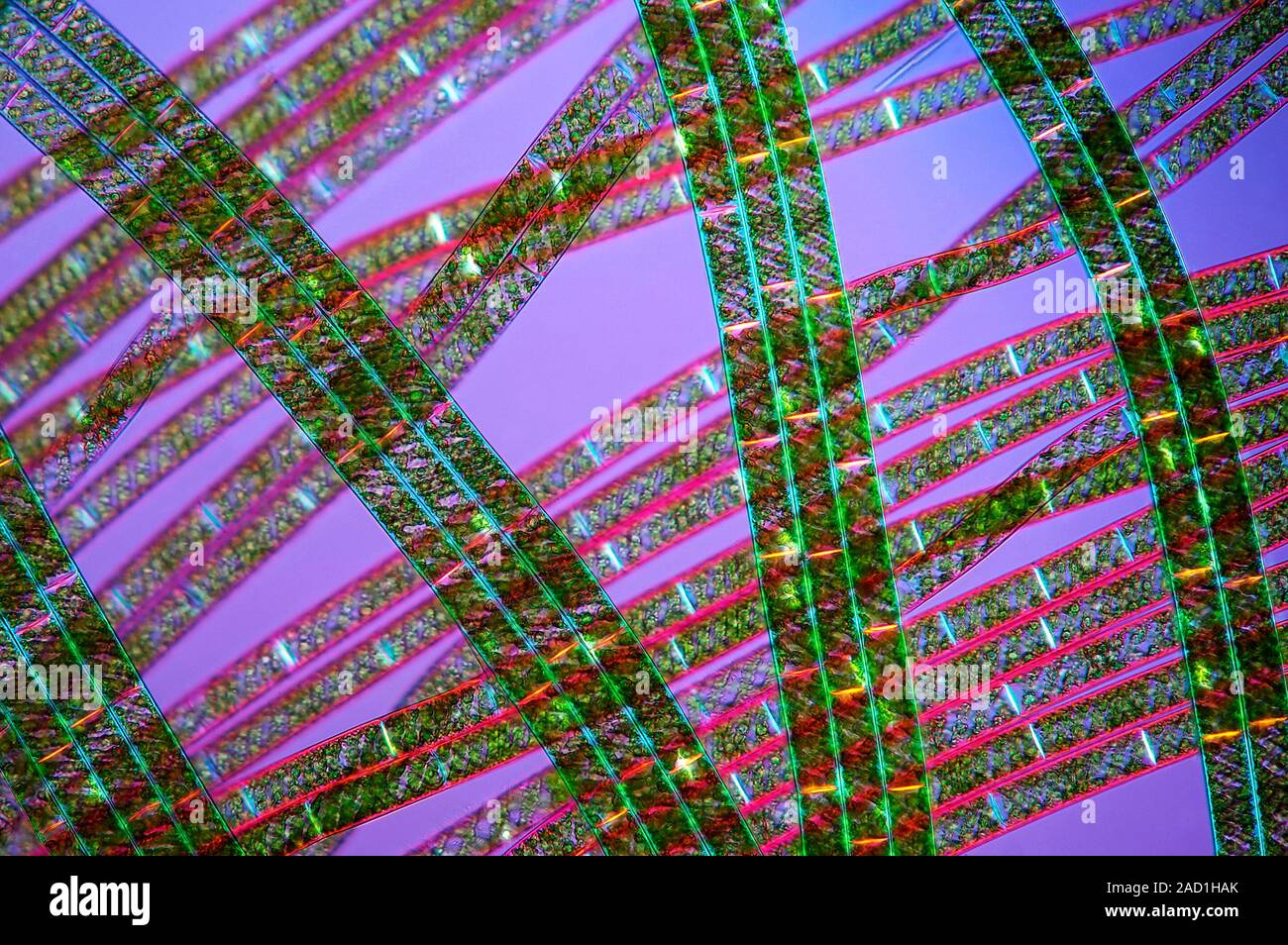 Spirogyra algae. Polarised light micrograph of Spirogyra sp. algae ...