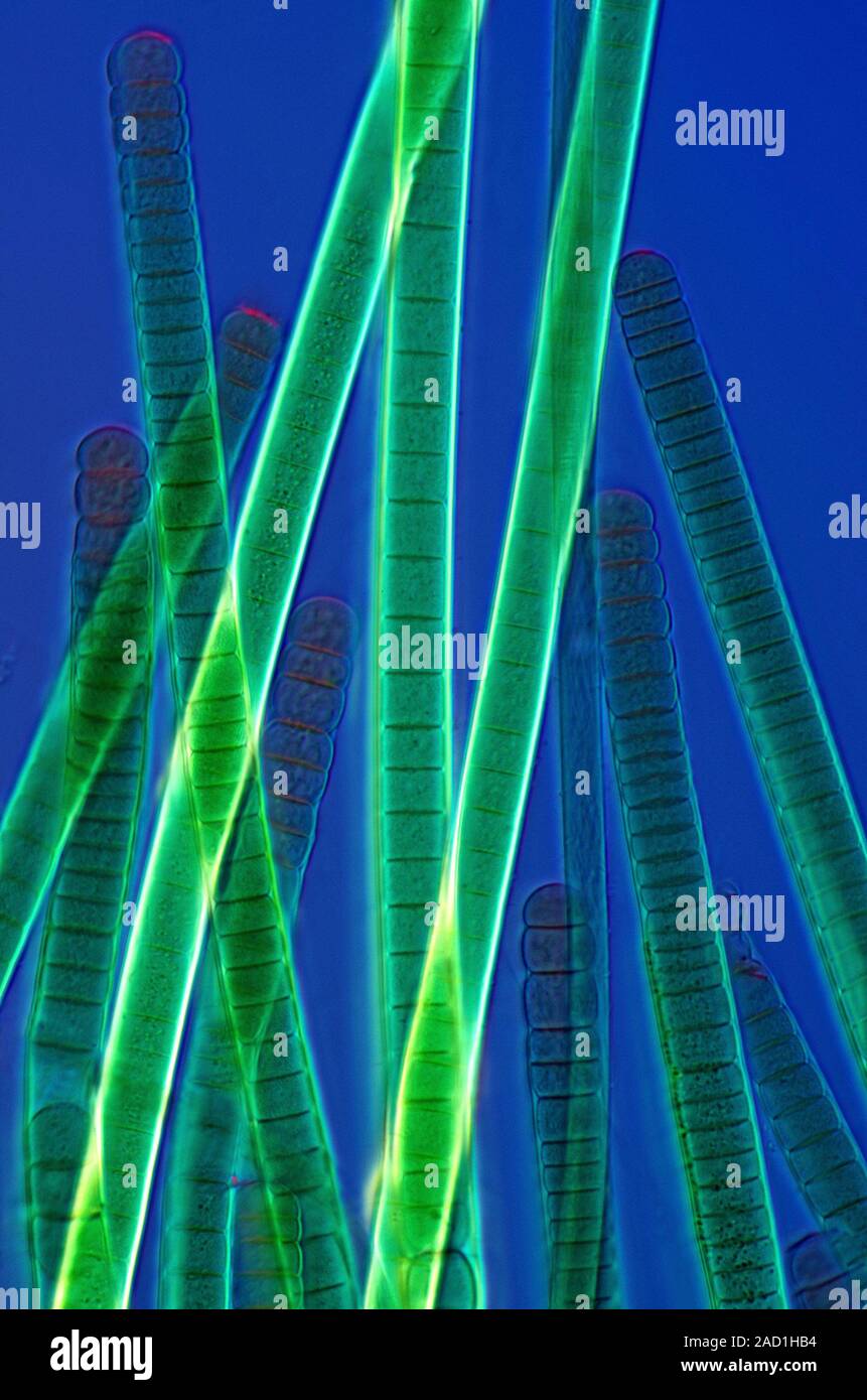 Cyanobacteria. Polarised light micrograph of Oscillatoria sp ...