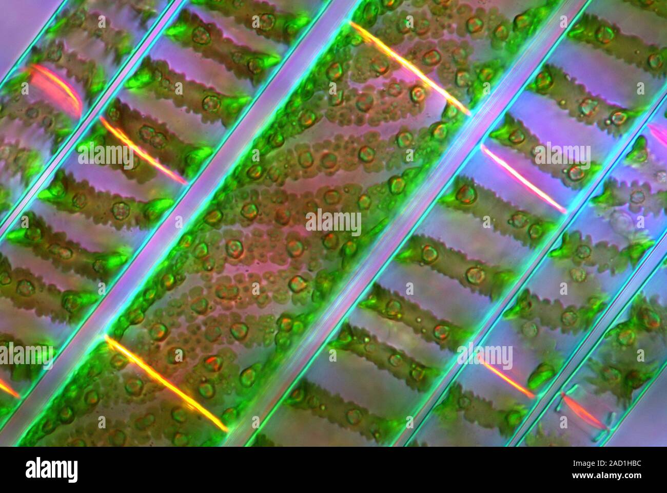 Spirogyra algae. Polarised light micrograph of Spirogyra sp. algae ...