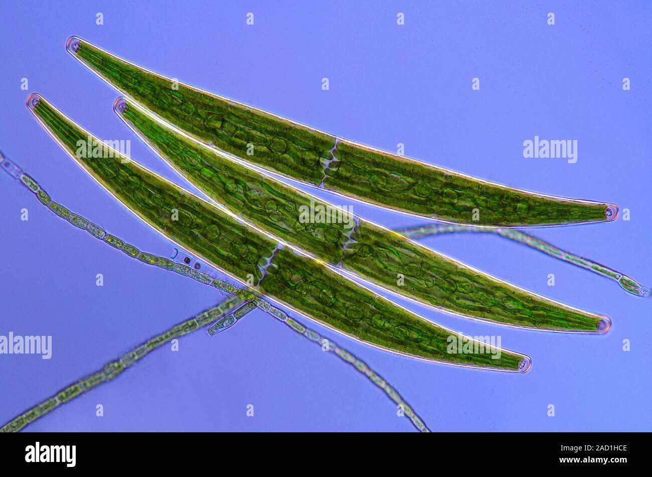 Closterium desmids. Polarised light micrograph of Closterium sp ...