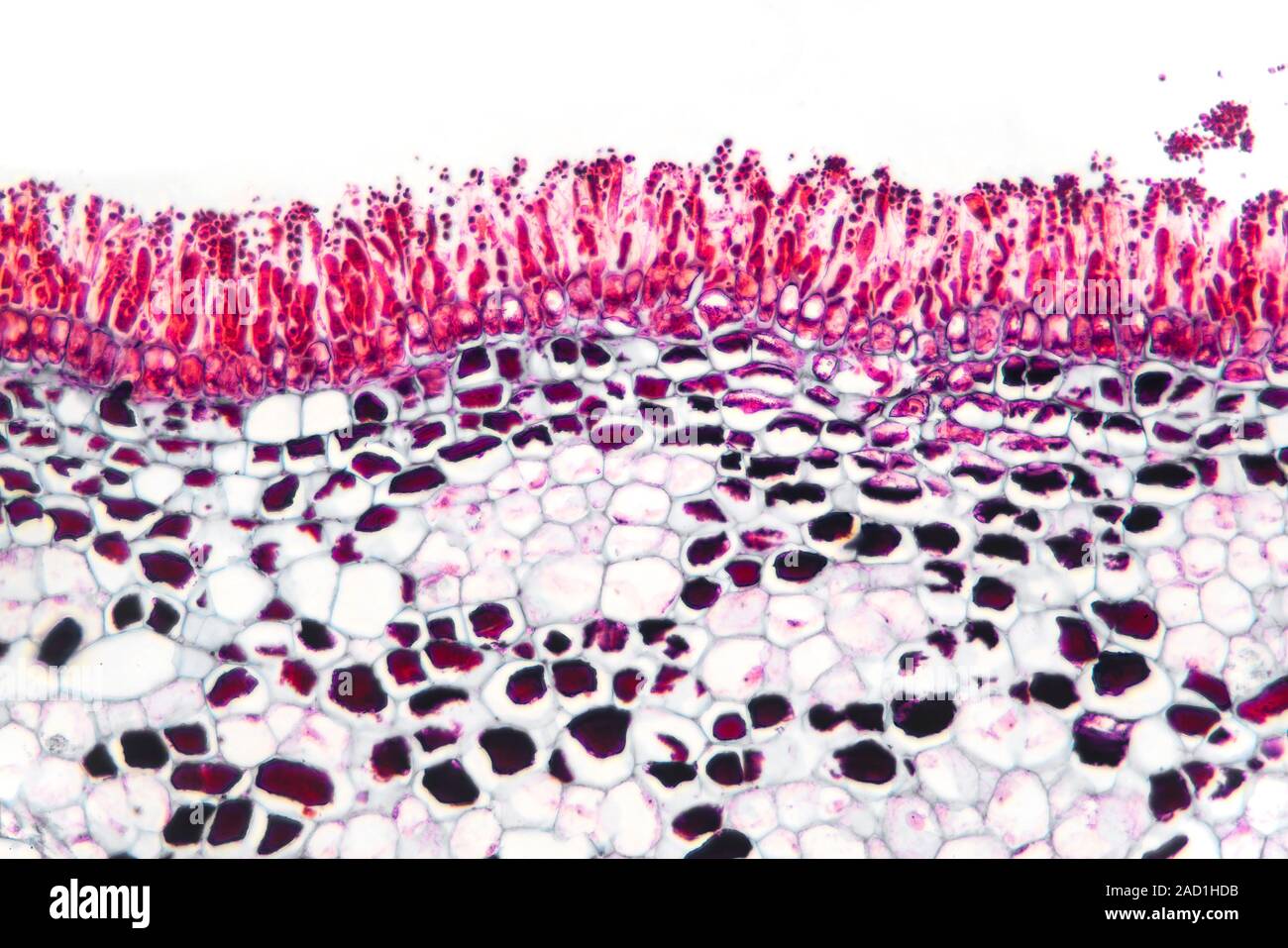 Taphrina fungus on skin of Prunus spinosa Stock Photo - Alamy